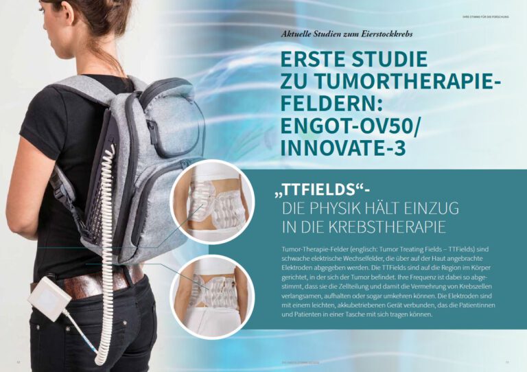 "TTFields" - physics finds its way into cancer therapy - Stiftung ...